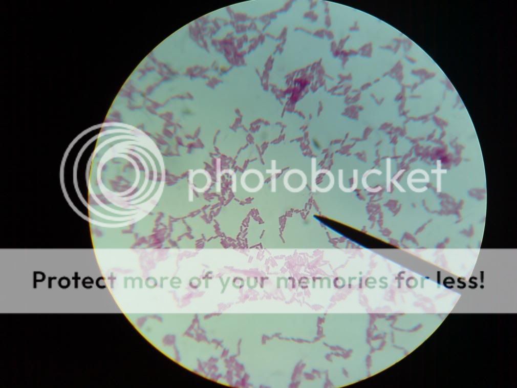 Typical Bacillus Gram Negative Smear Oil Immersion Photo by ...